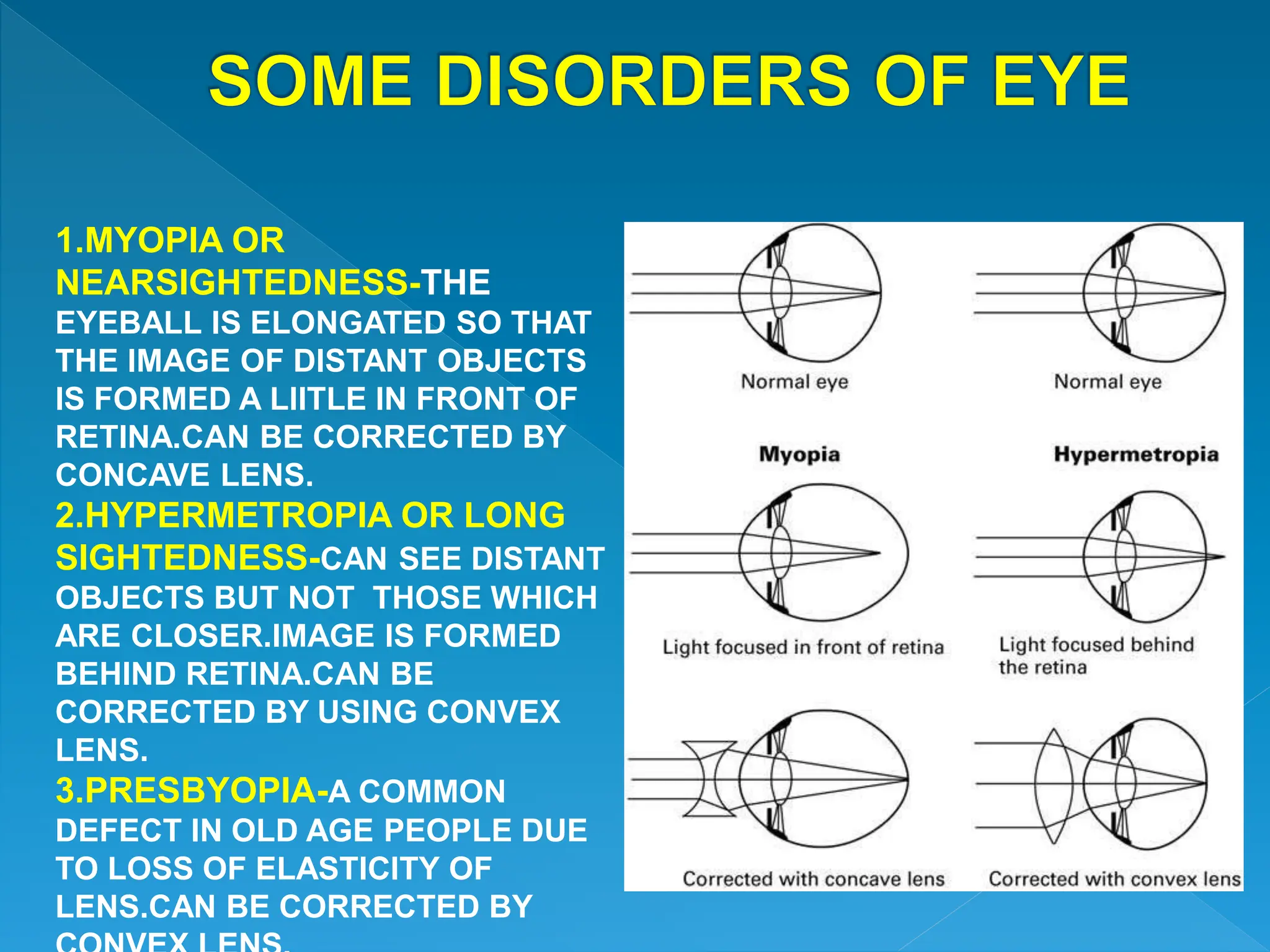 Mechanism of Vision in Human Beings with Diagram | PPTX | Eye and ...