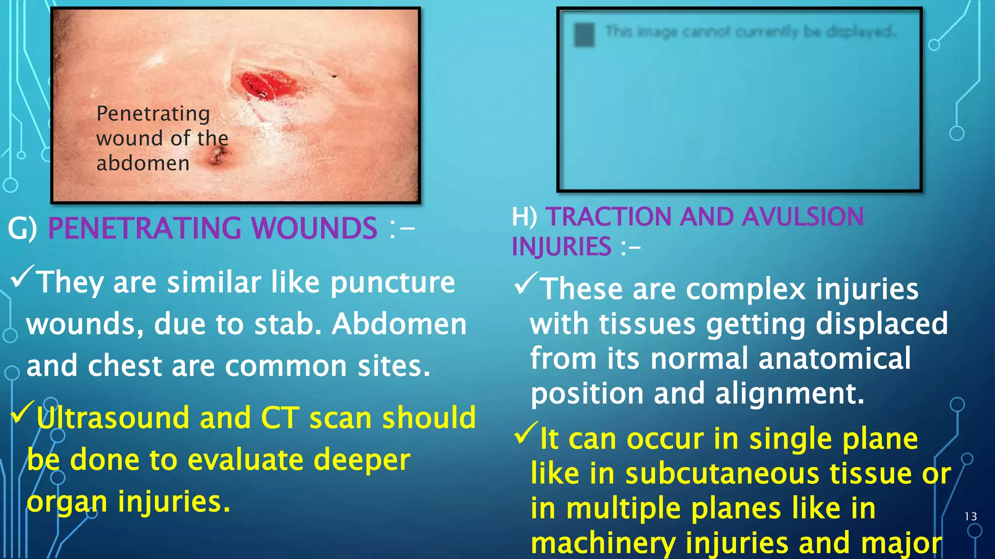 Mechanism of wound healing ppt | PPTX