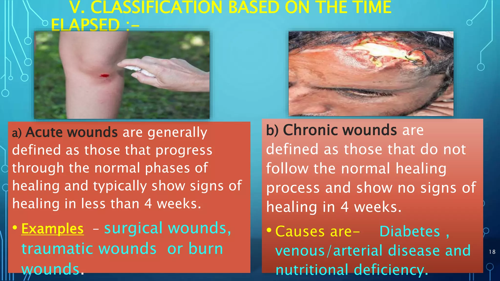 Mechanism of wound healing ppt | PPTX