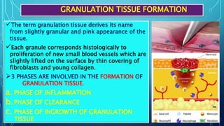 Mechanism of wound healing ppt | PPTX