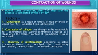 Mechanism of wound healing ppt | PPTX