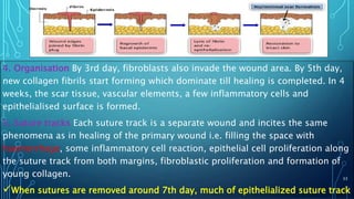 Mechanism of wound healing ppt | PPTX