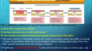 Mechanism of wound healing ppt | PPTX