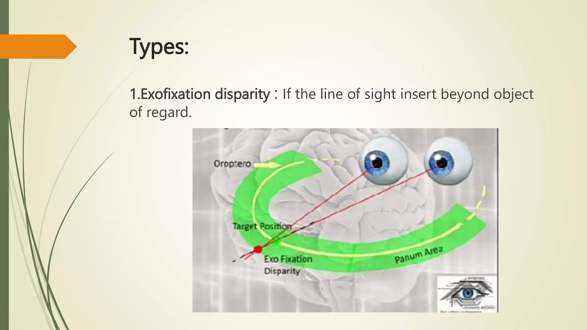 MECHANISMS AND TERMINOLOGIES IN BINOCULAR VISION.pptx