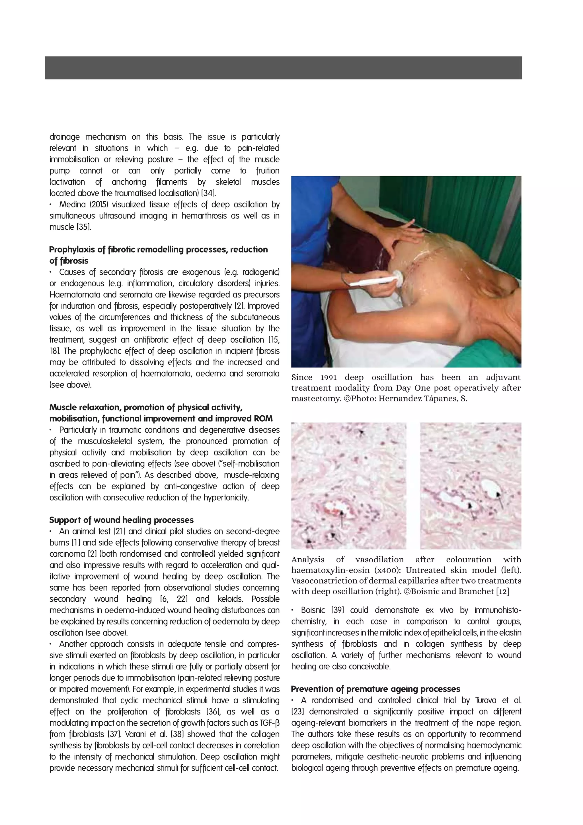 Mechanisms of Deep Oscillation | PDF
