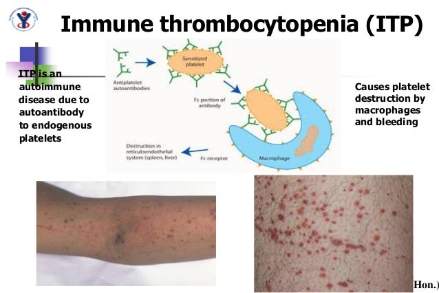 Mechanisms in autoimmunity and cancer