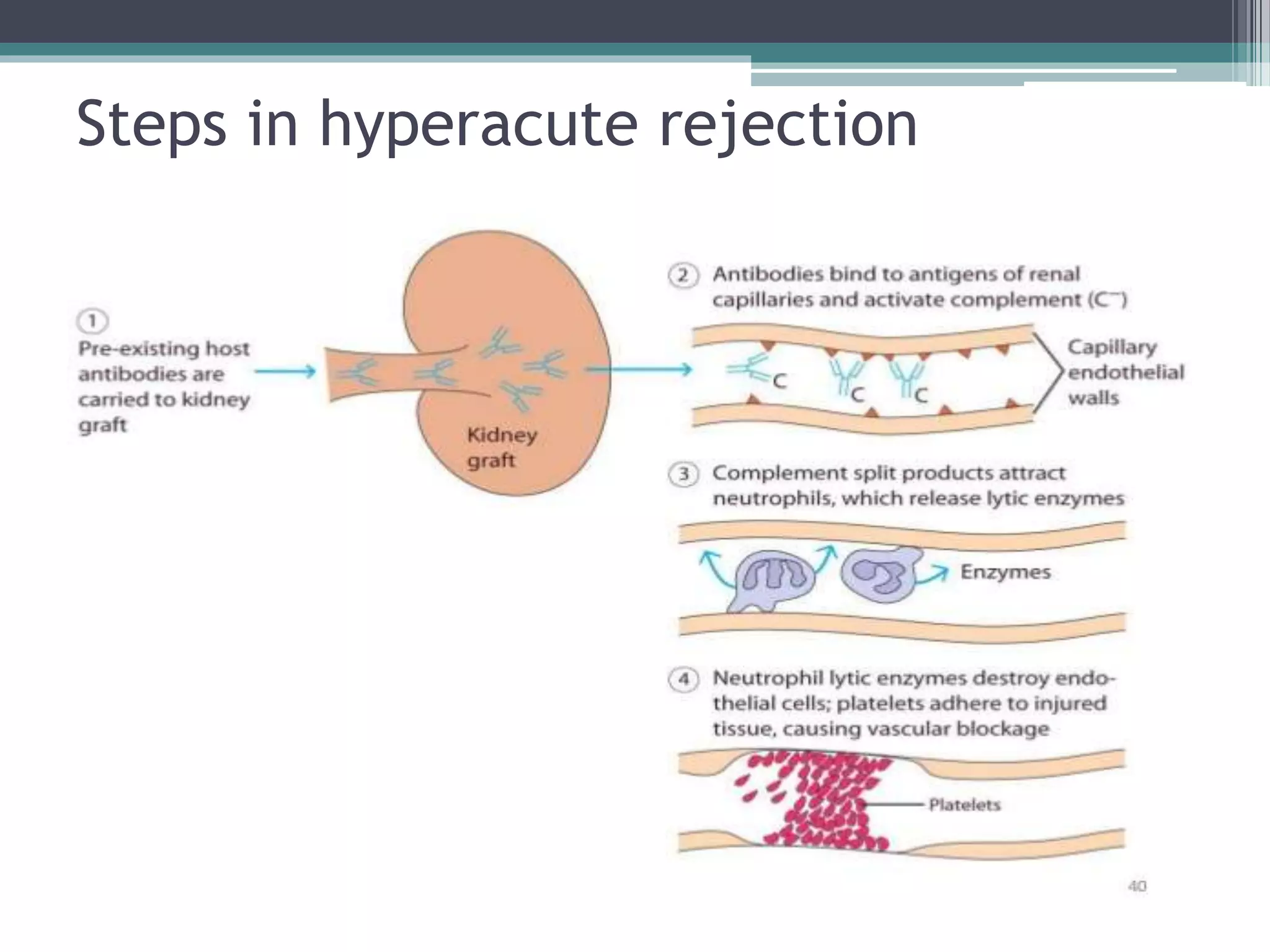 Mechanisms of allograft rejection | PPTX