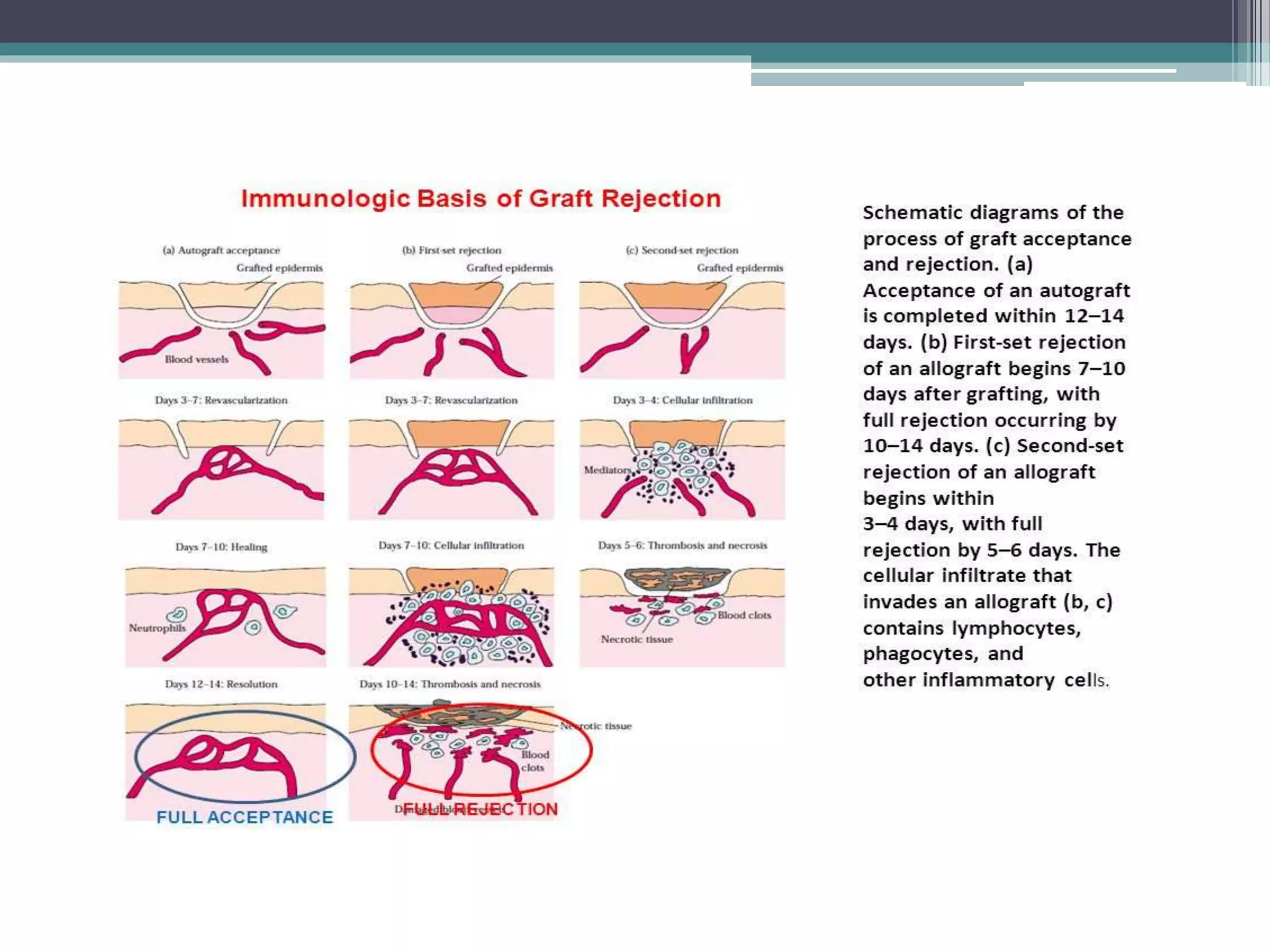 Mechanisms of allograft rejection | PPTX