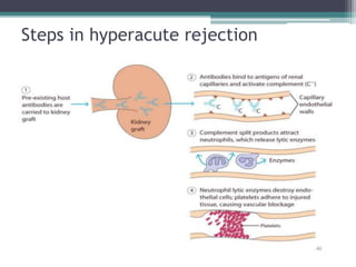 Mechanisms of allograft rejection | PPTX