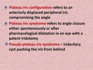 Mechanisms of angle closure glaucoma | PPTX