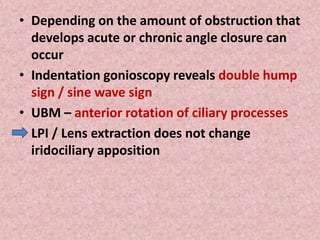 Mechanisms of angle closure glaucoma | PPTX