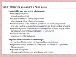 Mechanisms of angle closure glaucoma | PPTX