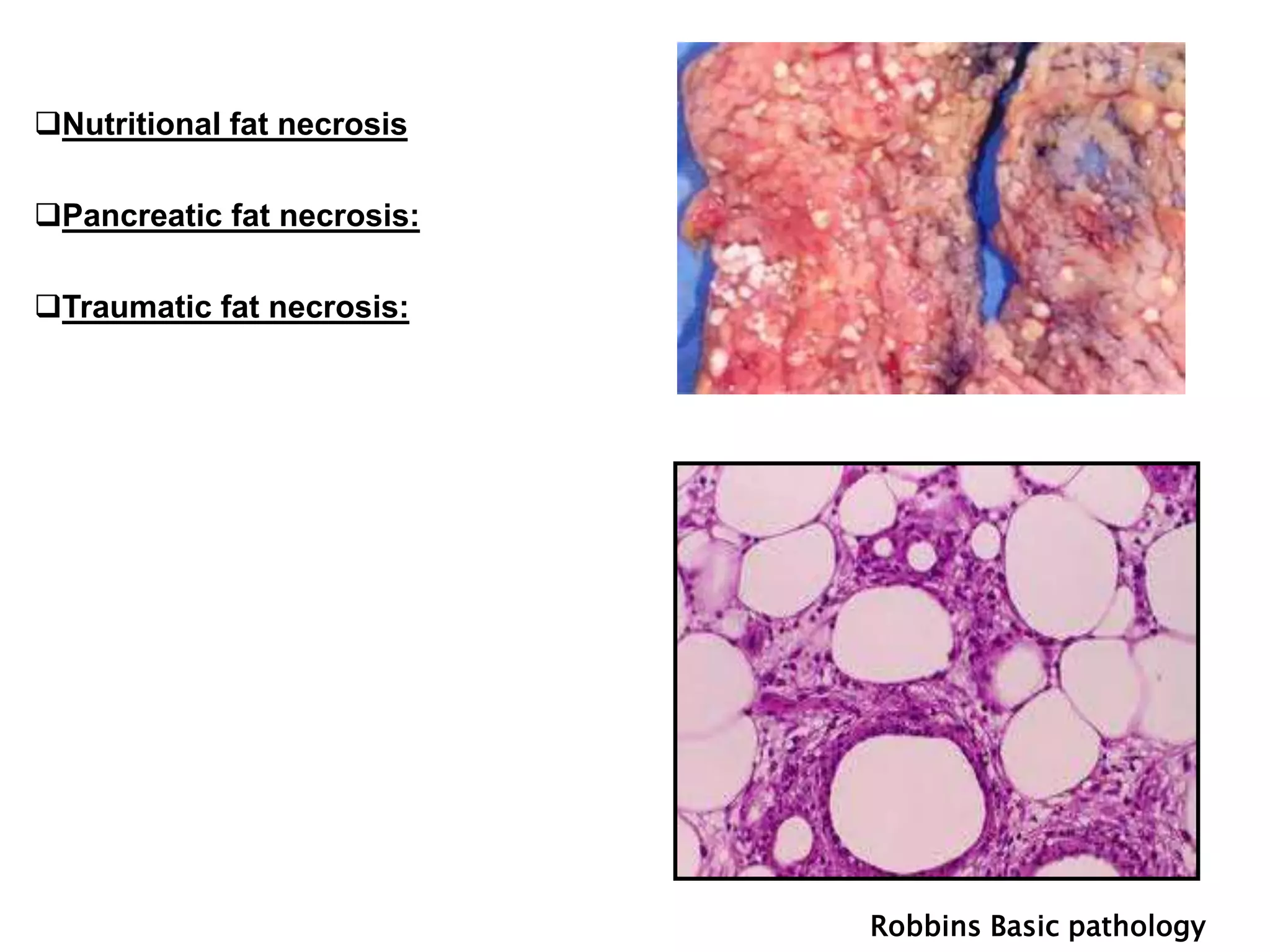 Mechanisms of cell death | PPT