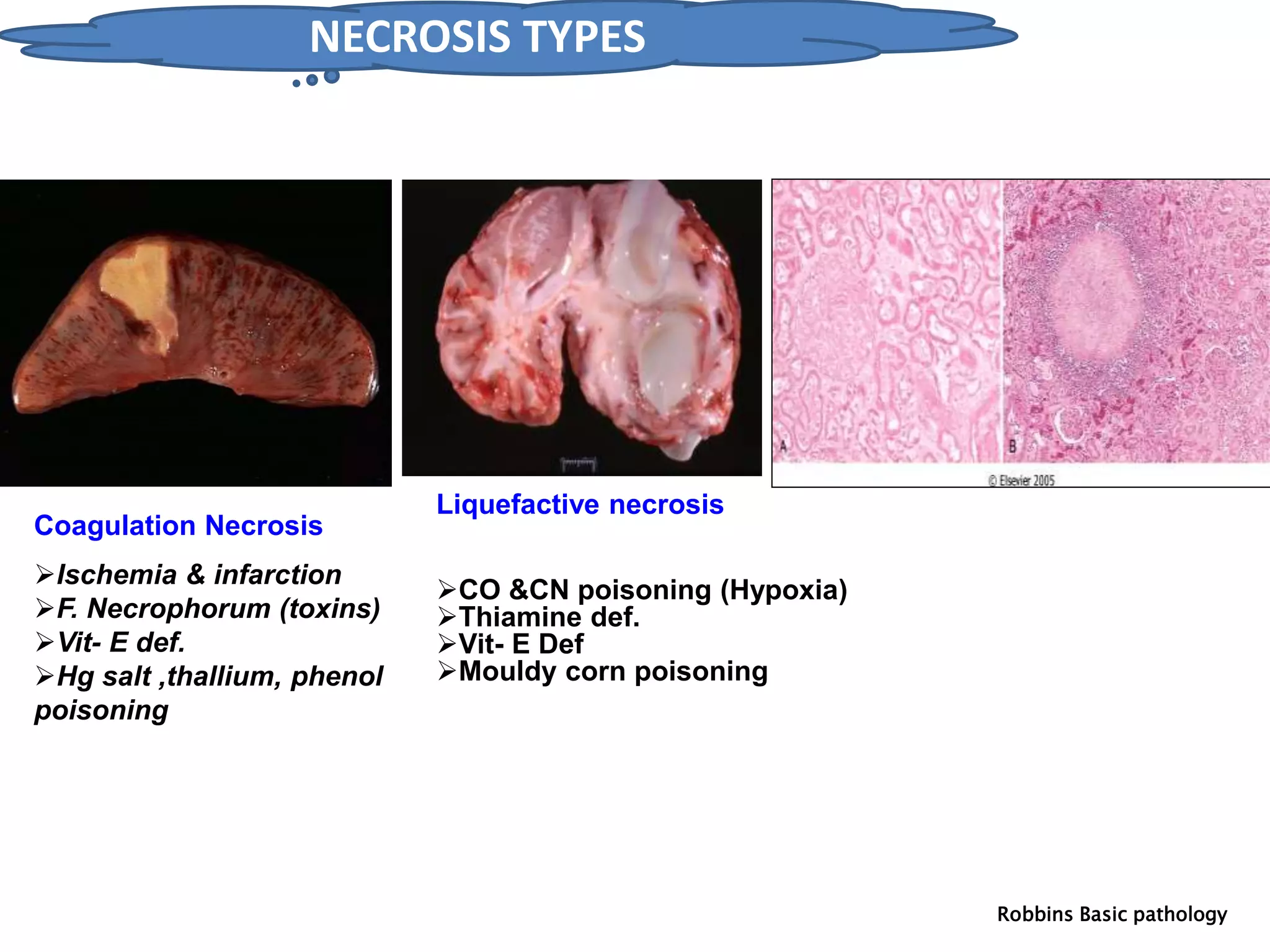 Mechanisms of cell death | PPT