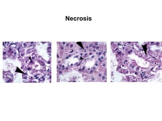 Mechanisms of cell death | PPT