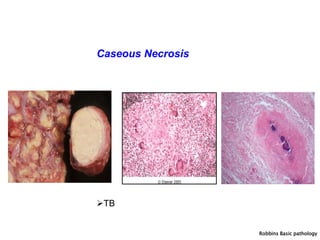 Mechanisms of cell death | PPT