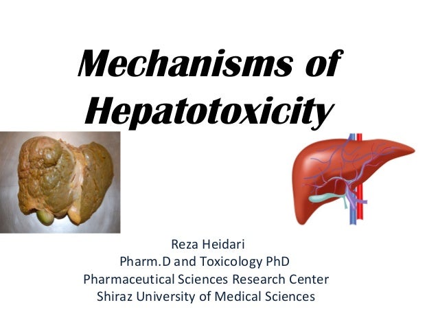 Mechanisms of Hepatotoxicity