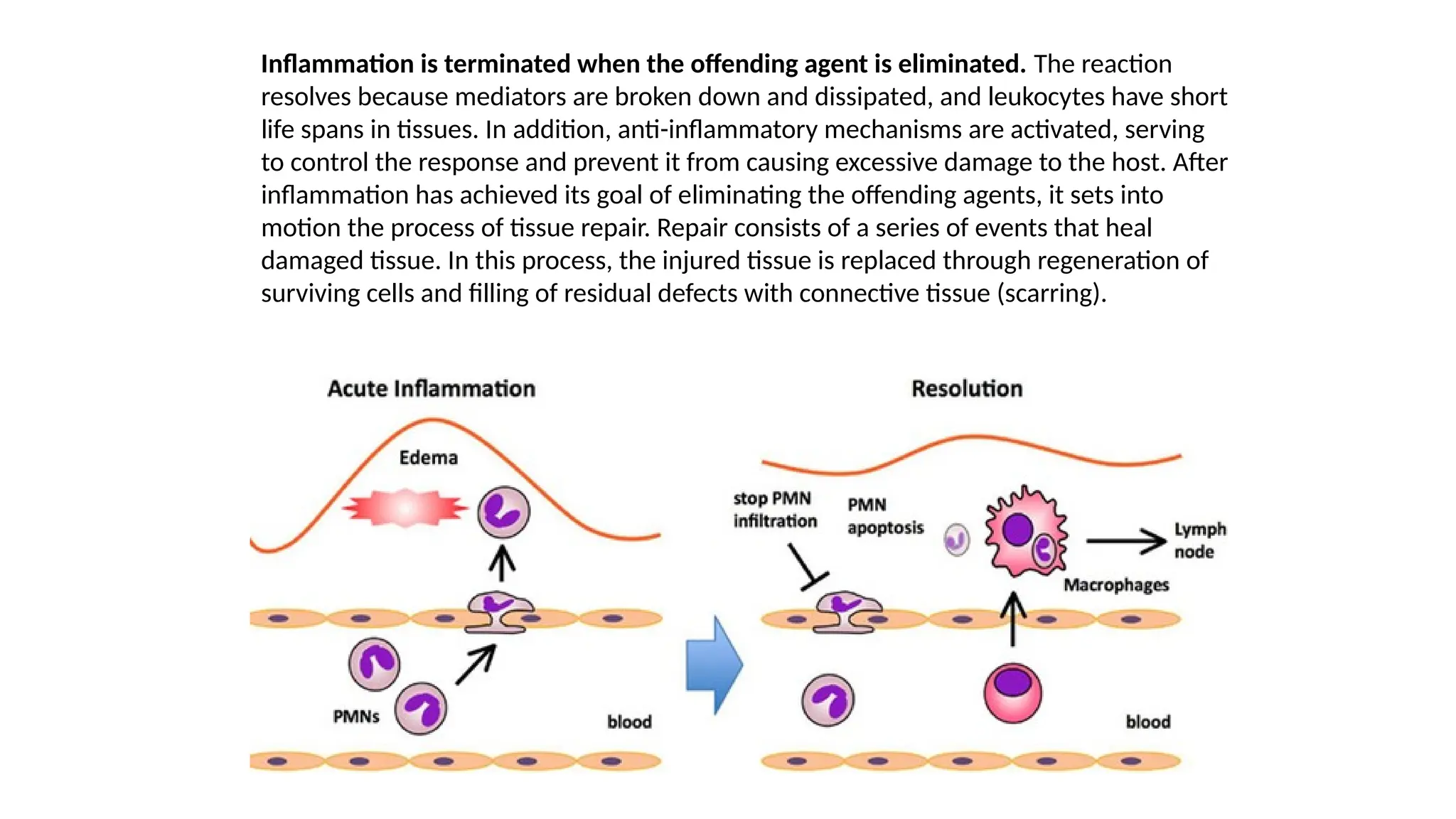 Mechanisms of Inflammation.kmu lecture... | PPTX