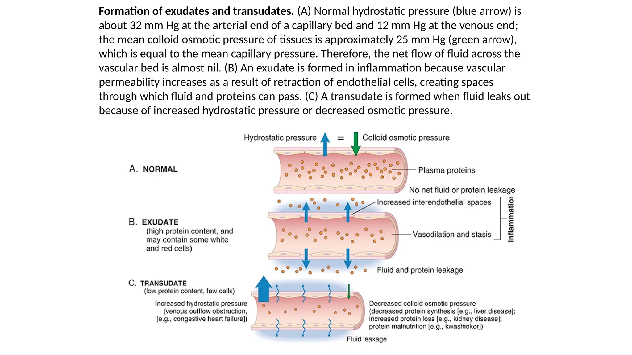 Mechanisms of Inflammation.kmu lecture... | PPTX