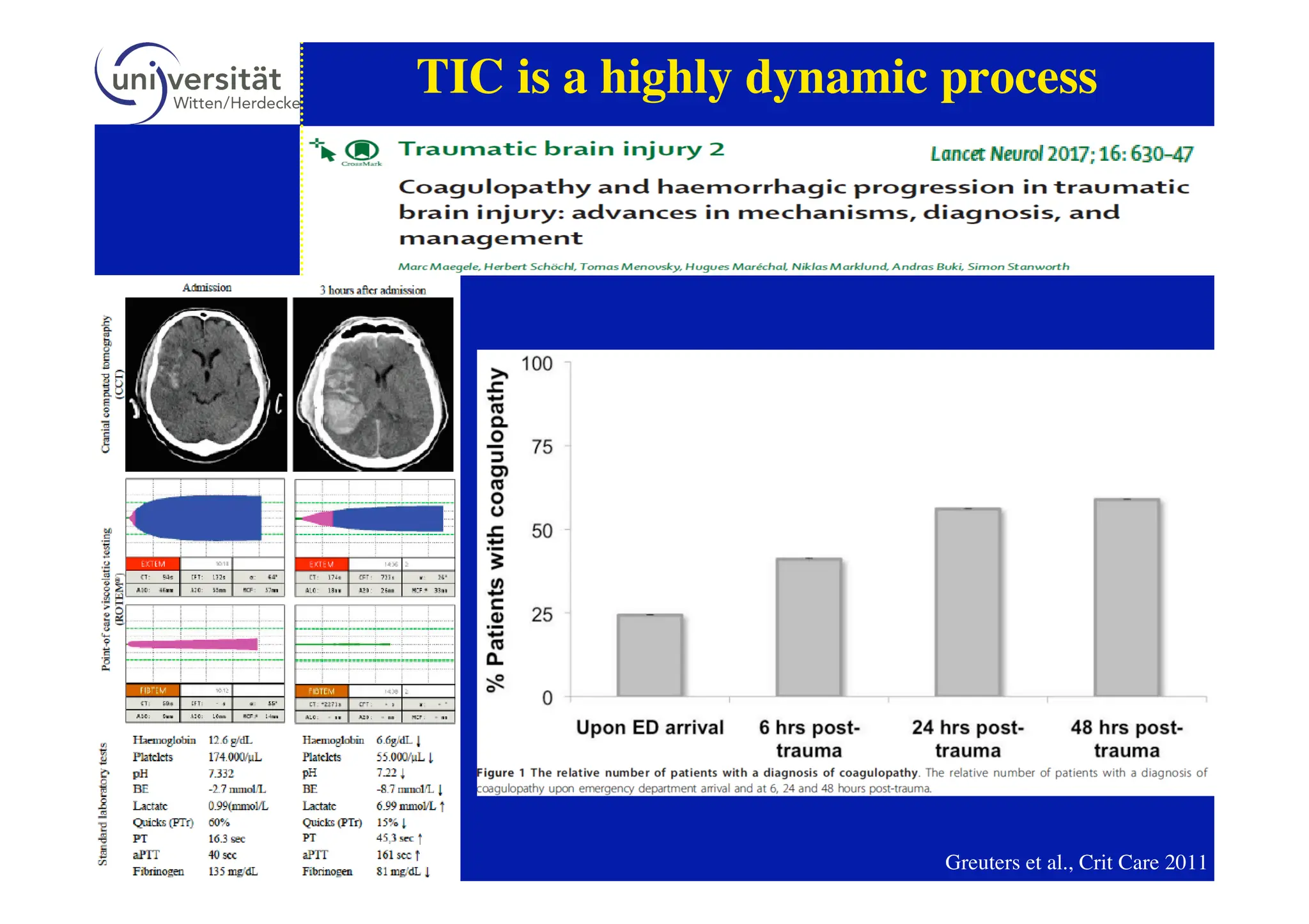 Mechanisms of trauma-induced coagulopathy specific acidosis and all.pdf