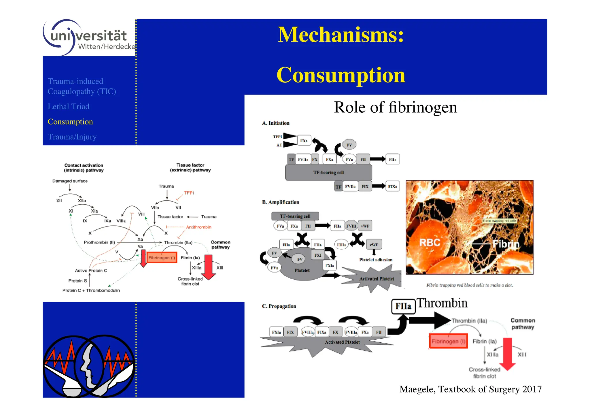 Mechanisms of trauma-induced coagulopathy specific acidosis and all.pdf