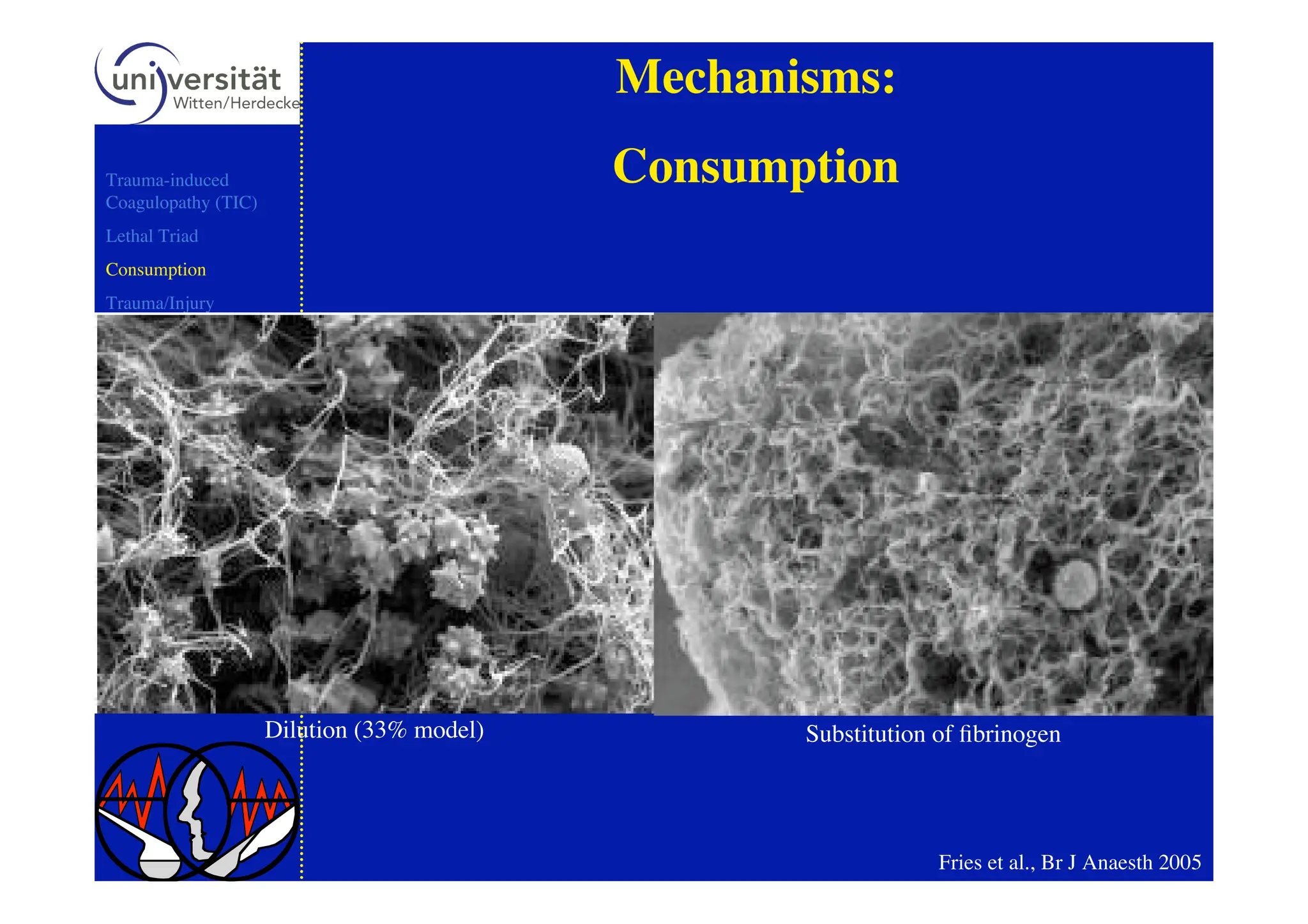 Mechanisms of trauma-induced coagulopathy specific acidosis and all.pdf