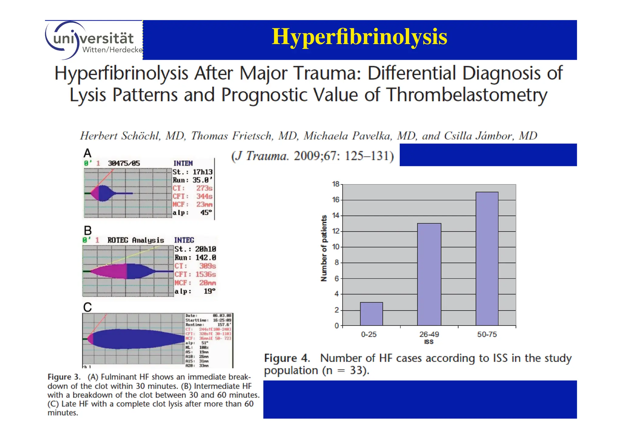 Mechanisms of trauma-induced coagulopathy specific acidosis and all.pdf