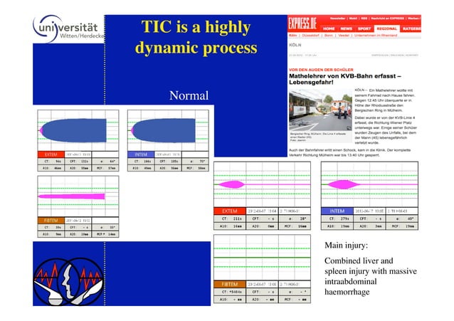 Mechanisms of trauma-induced coagulopathy specific acidosis and all.pdf