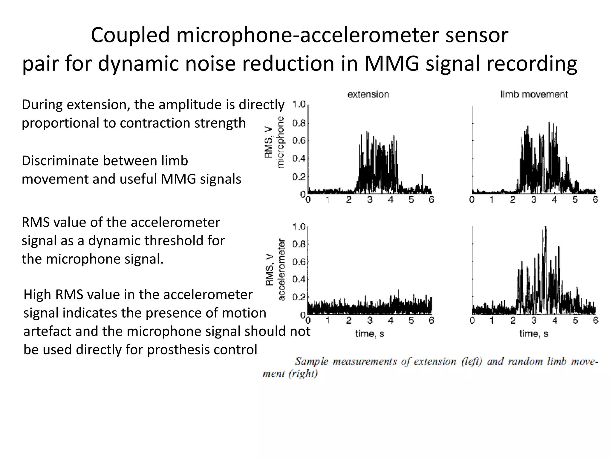 Mechanomyogram chandra sen vikram | PDF