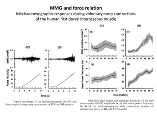 Mechanomyogram chandra sen vikram | PDF