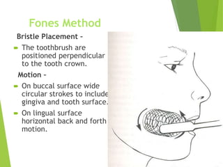 Mechanical plaque control | PPT