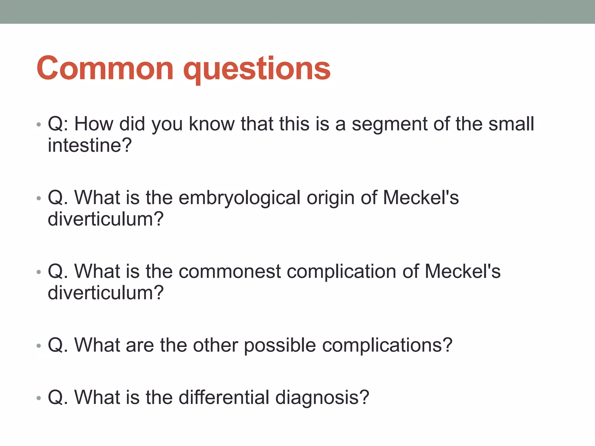 Meckel’s diverticulum simple overview | PPTX