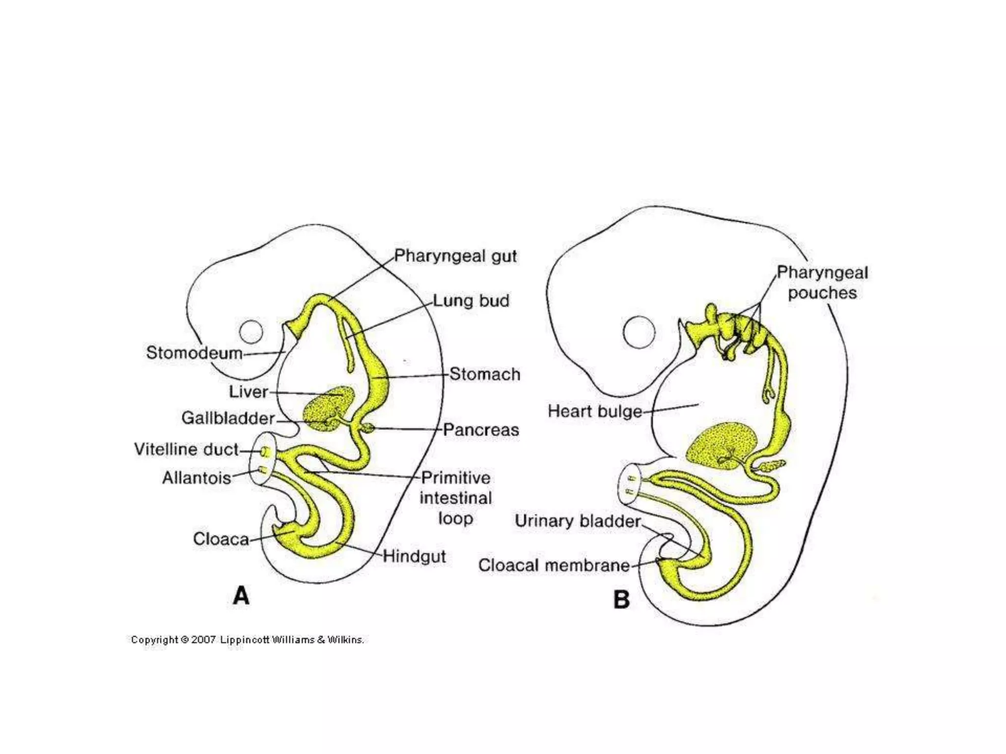 Meckel diverticulum | PPTX