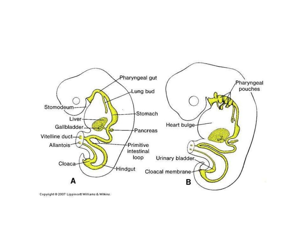 Meckel diverticulum