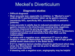 Meckels div | PPT