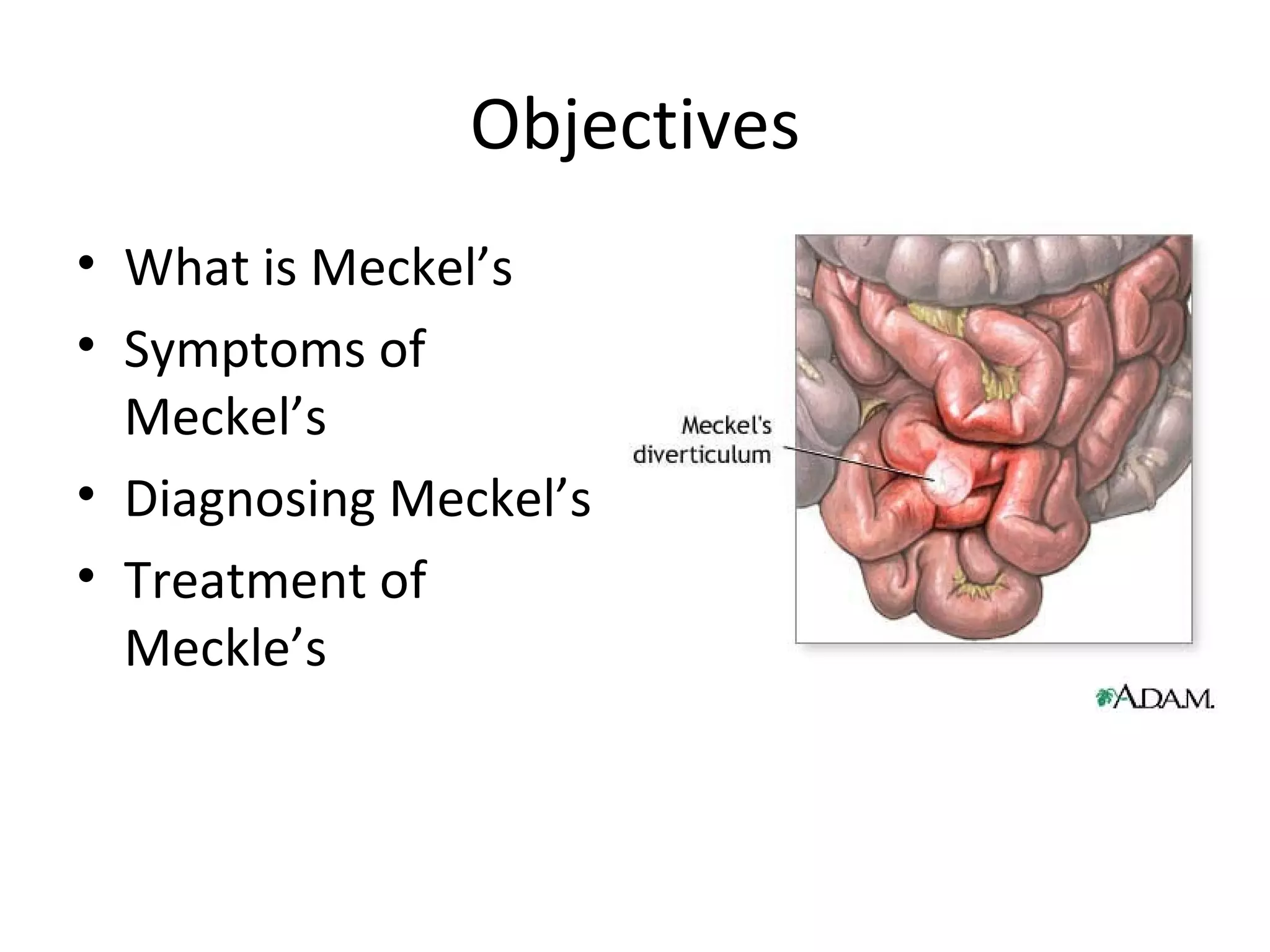 Meckelsdiverticulum | PPT