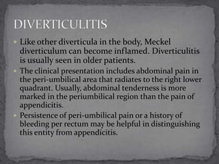 Meckel’s diverticulum | PPTX
