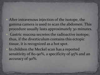 Meckel’s diverticulum | PPTX