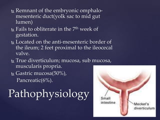 Meckels Diverticulum | PPTX