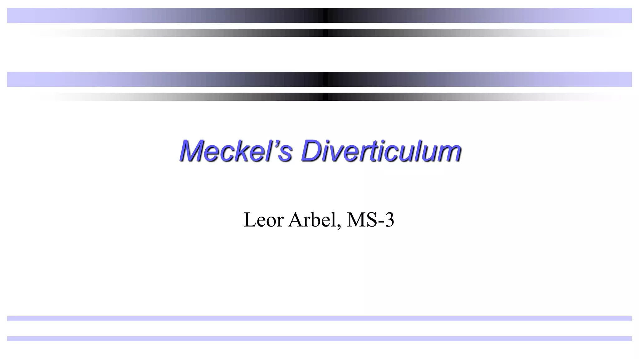 Meckel’s diverticulum | PPTX