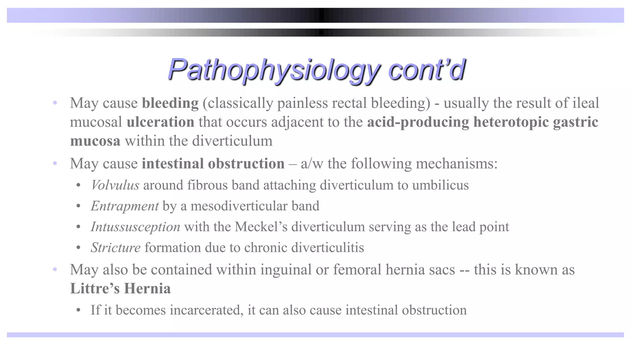 Meckel’s diverticulum | PPTX