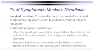 Meckel’s diverticulum | PPTX