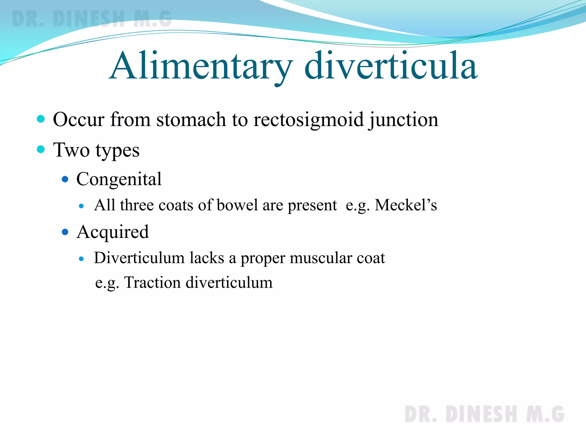 Meckel's Diverticulum | PDF