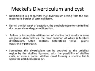 Meckels diverticulum | PPT