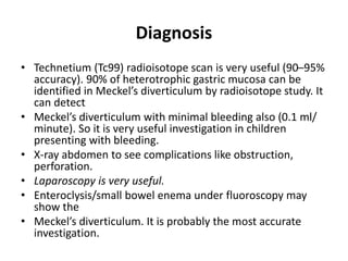 MECKEL’S DIVERTICULUM.pptx