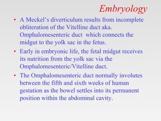 Meckel's Diverticulum.pptx