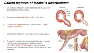 Meckel’s diverticulum.pdf