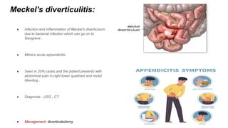 Meckel’s diverticulum.pdf