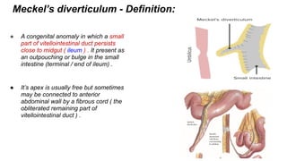 Meckel’s diverticulum.pdf