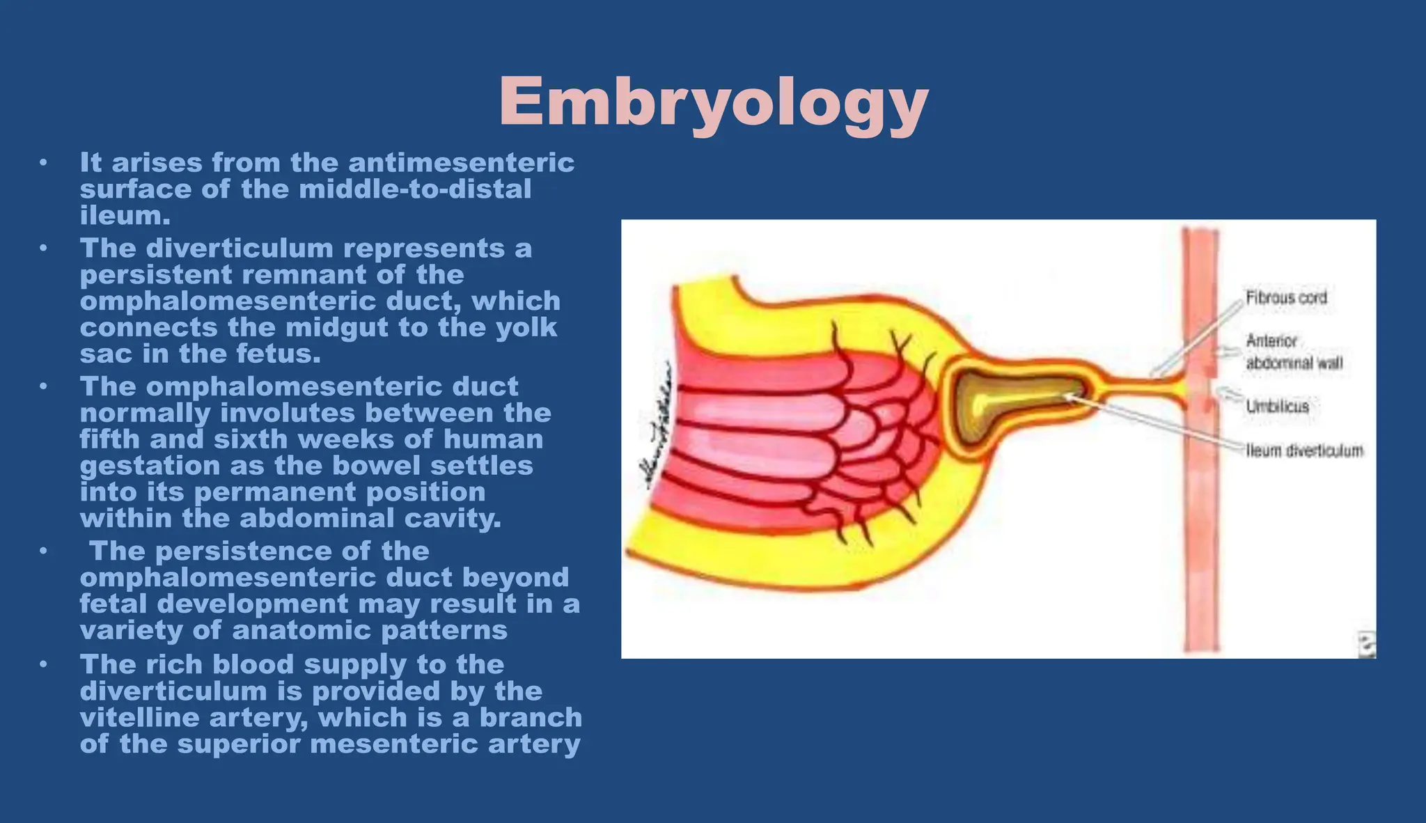meckels diverticulum.pptx